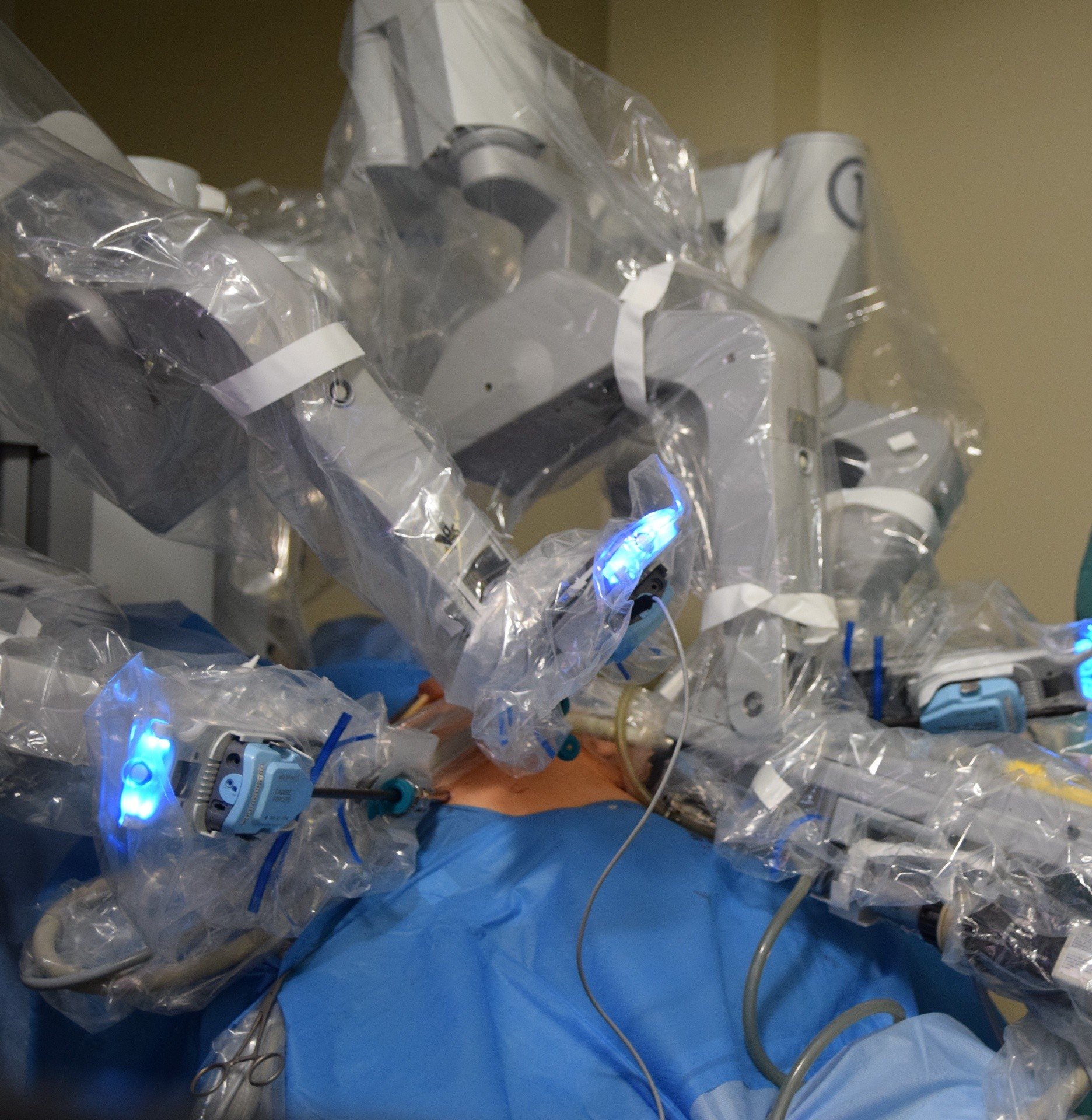 Łódź: Szpital Bonifratrów ma robota da Vinci. Lekarze wykonali przy ...