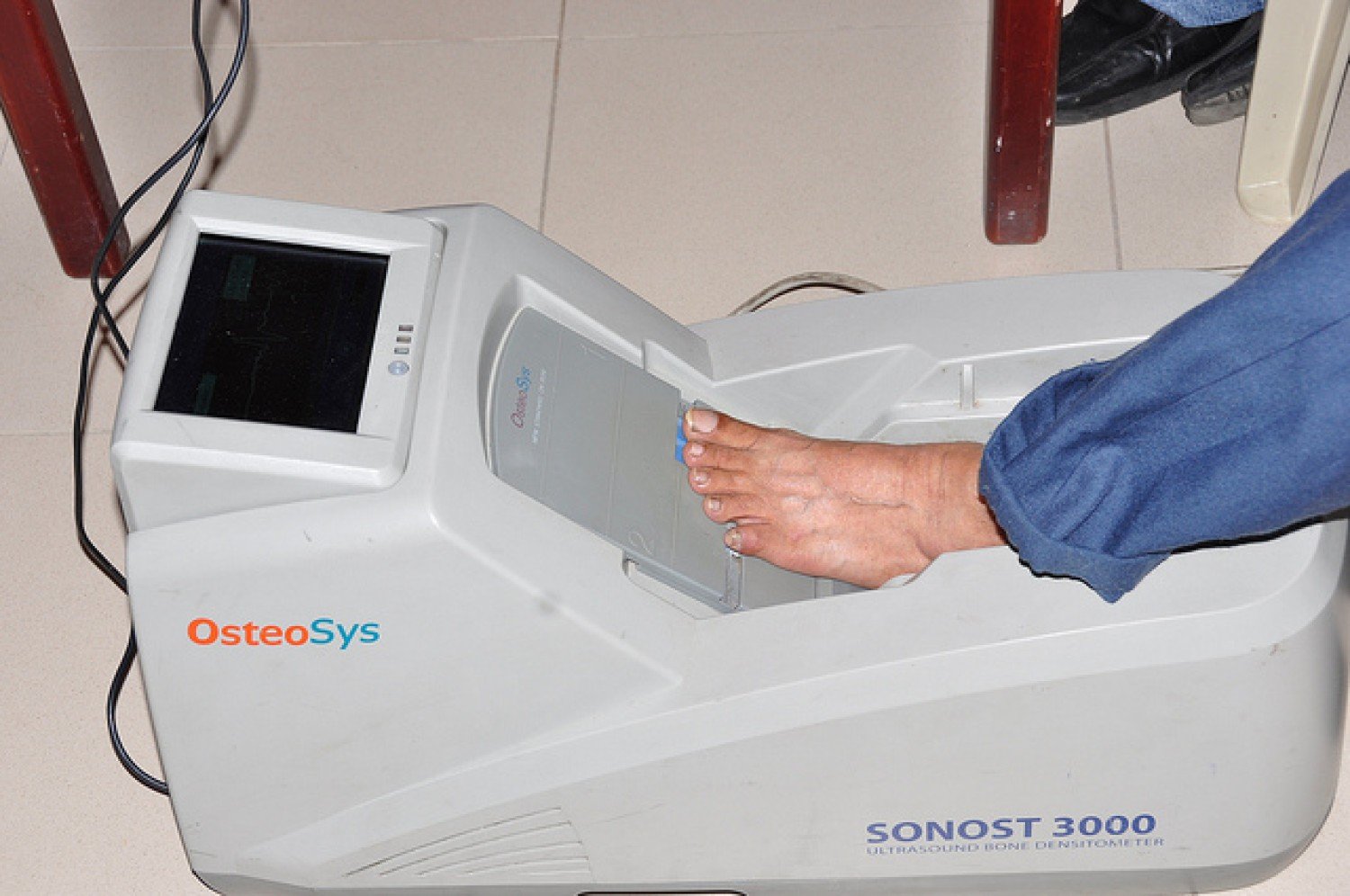 Choroby przewlekłe a występowanie osteoporozy | Olsztyn Nasze Miasto